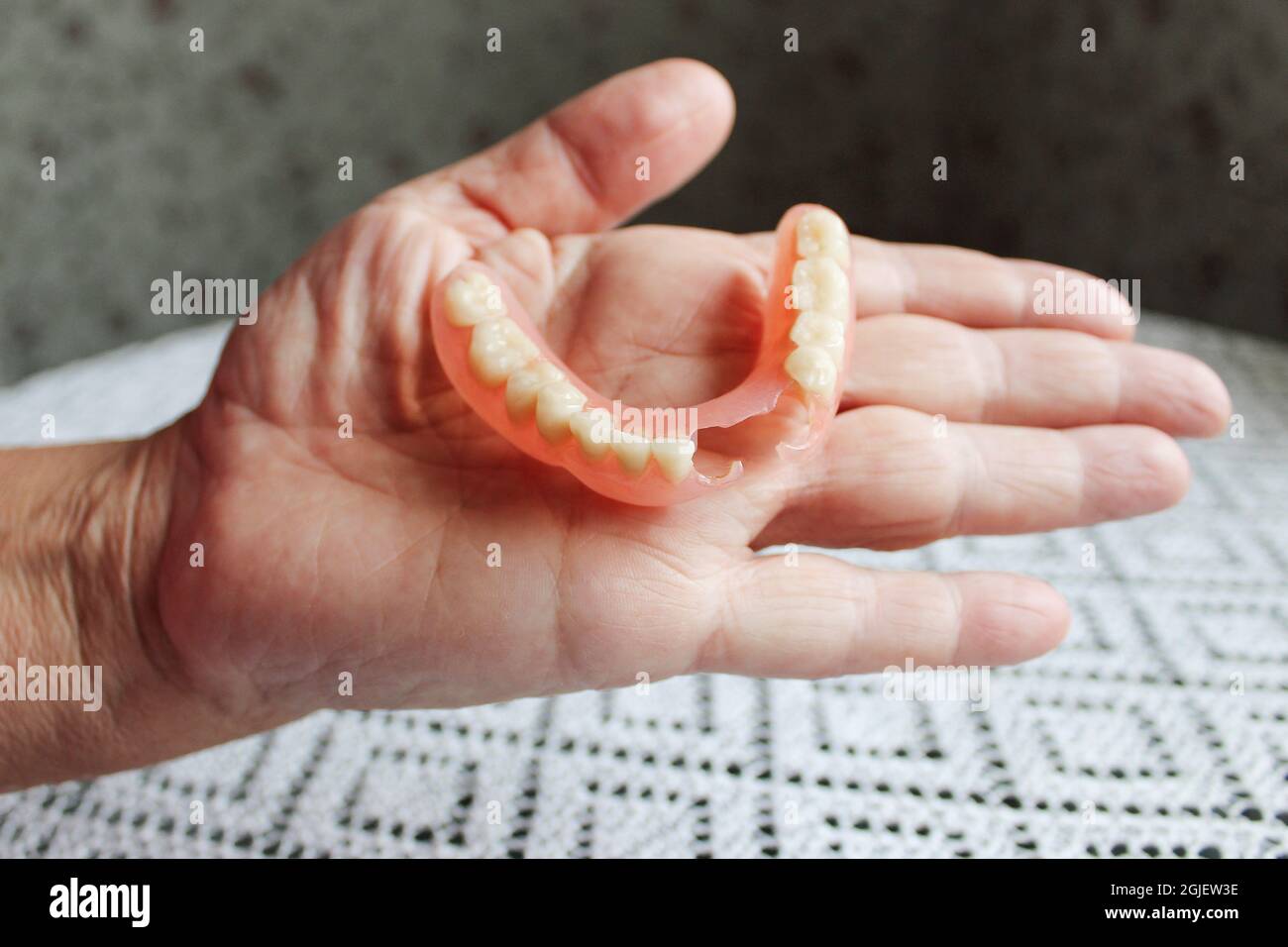 flexible nylon denture on male hand. Removable dentures flexible ...