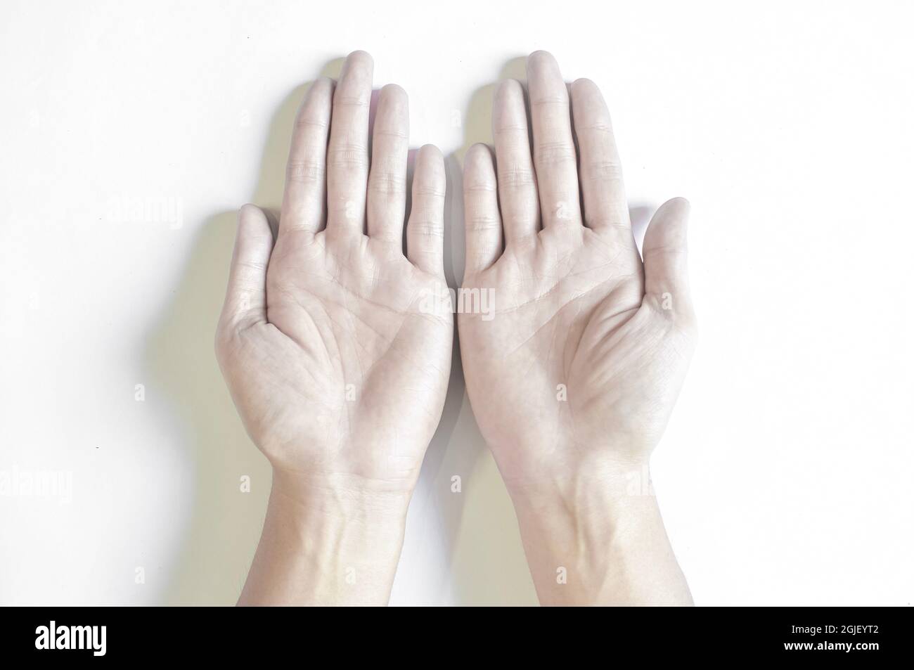 Pale skin anemia hi-res stock photography and images - Alamy