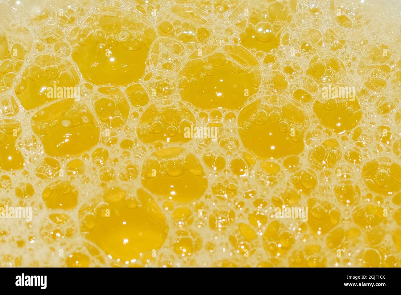 High color urine with bubbles. Foamy urine. Closeup view Stock Photo ...