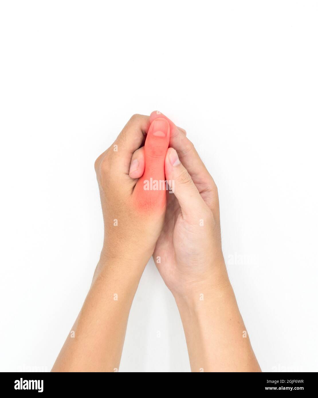 Inflammation at thumb of Asian young man. Concept of digital pain. Cellulitis. Isolated on white ...