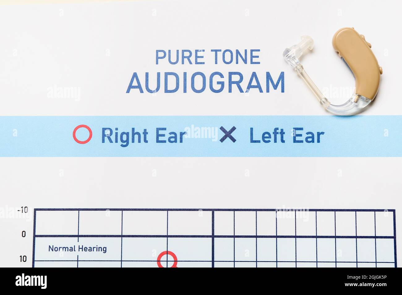 Audiogram hi-res stock photography and images - Alamy