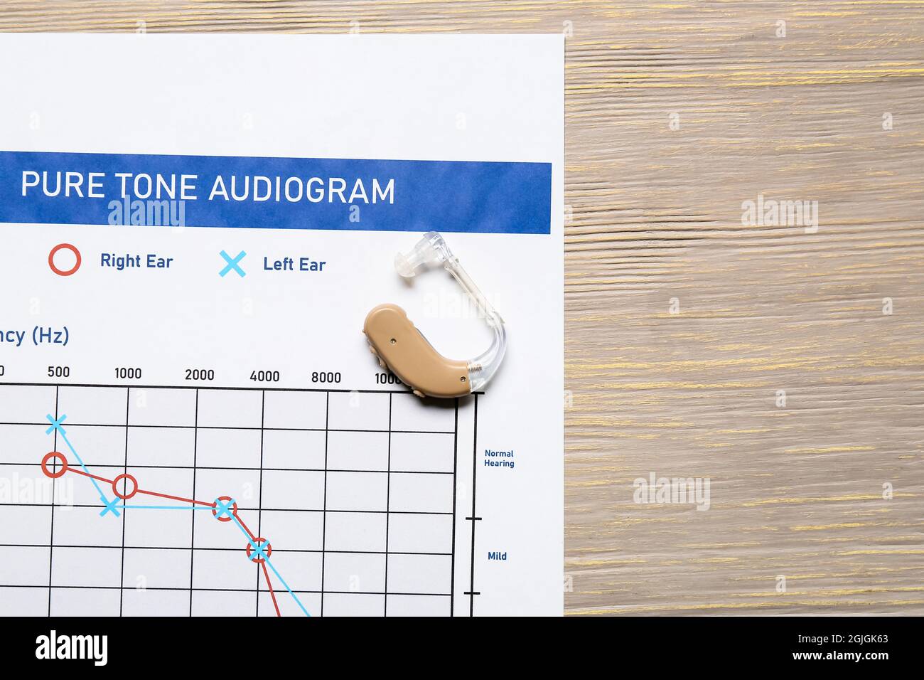Audiogram hi-res stock photography and images - Alamy