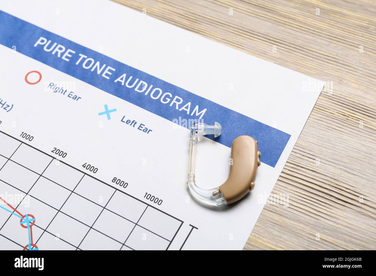 Audiogram hi-res stock photography and images - Alamy