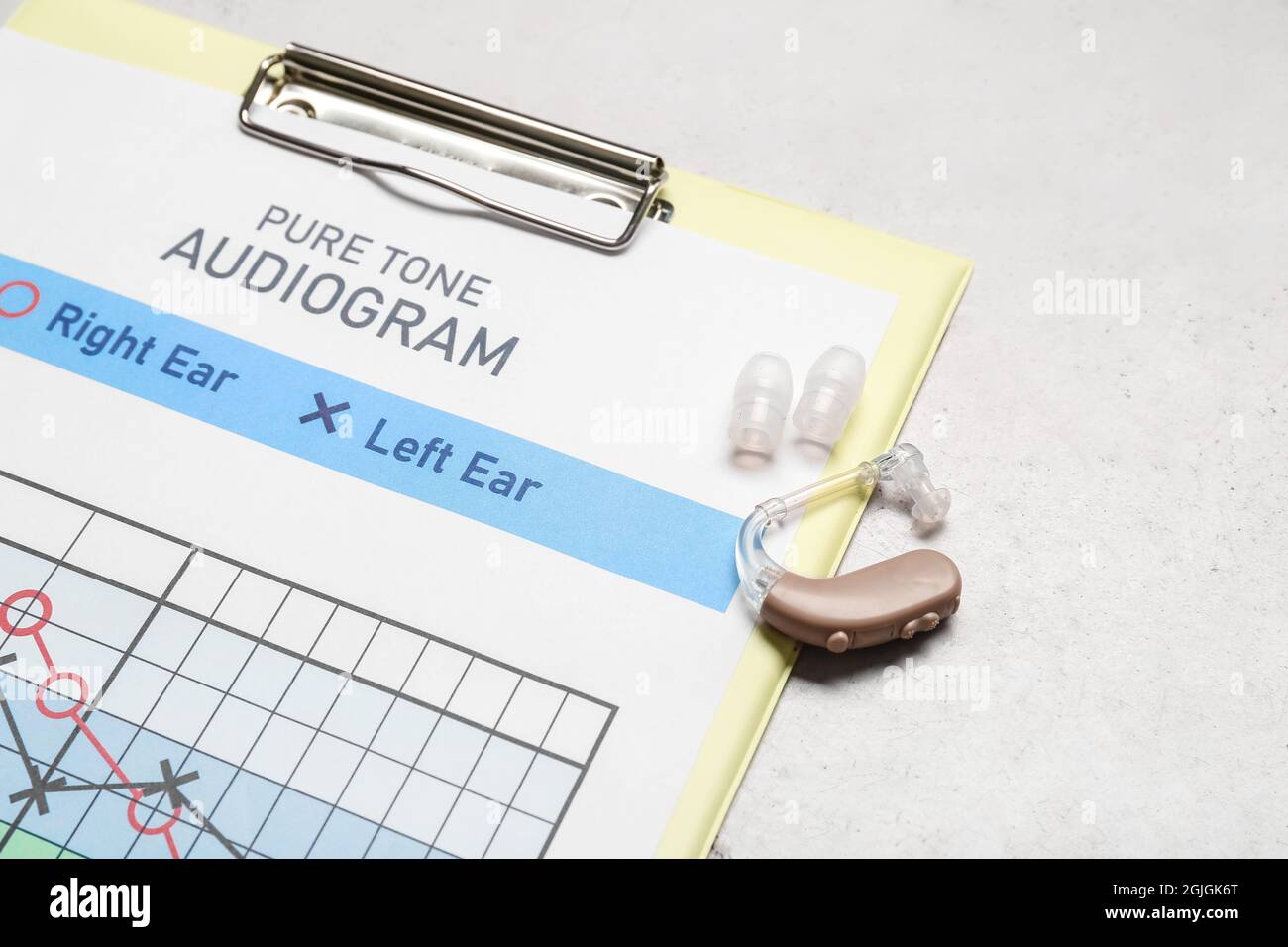 Audiogram with hearing aid on white background Stock Photo - Alamy