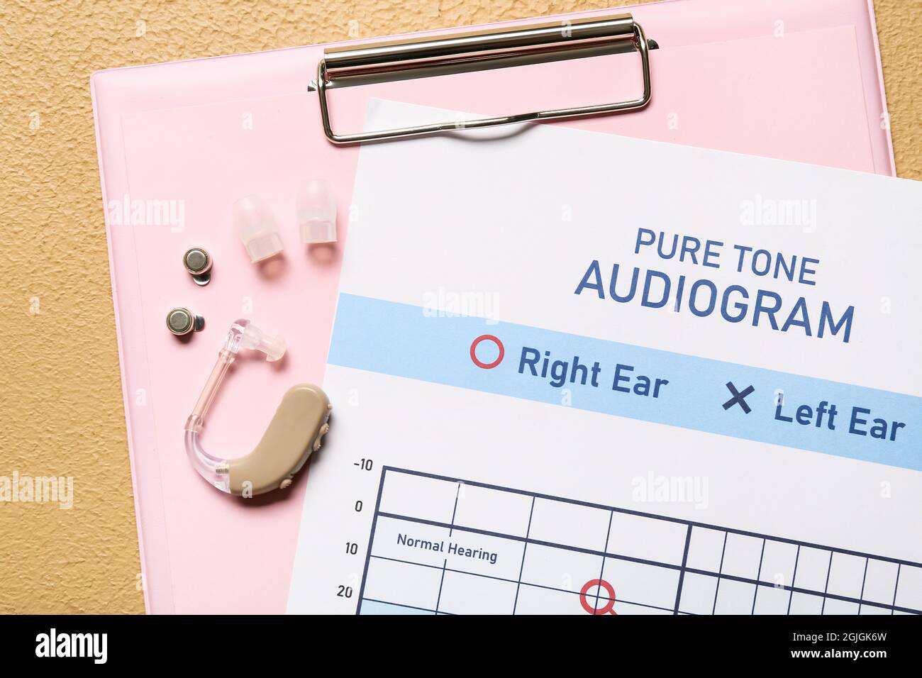 Audiogram with hearing aid and accessories on color background Stock ...