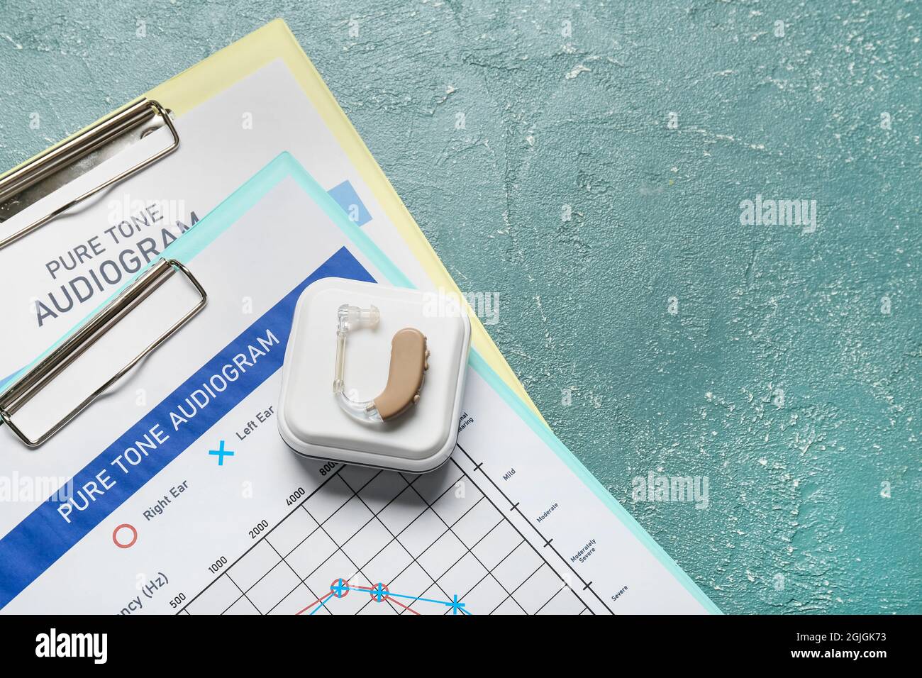 Audiograms with hearing aid on color background Stock Photo - Alamy