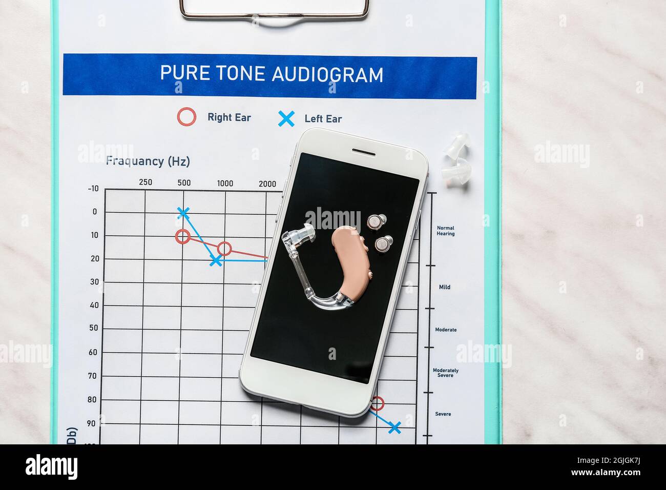 Mobile phone with hearing aid and audiogram on white background Stock ...