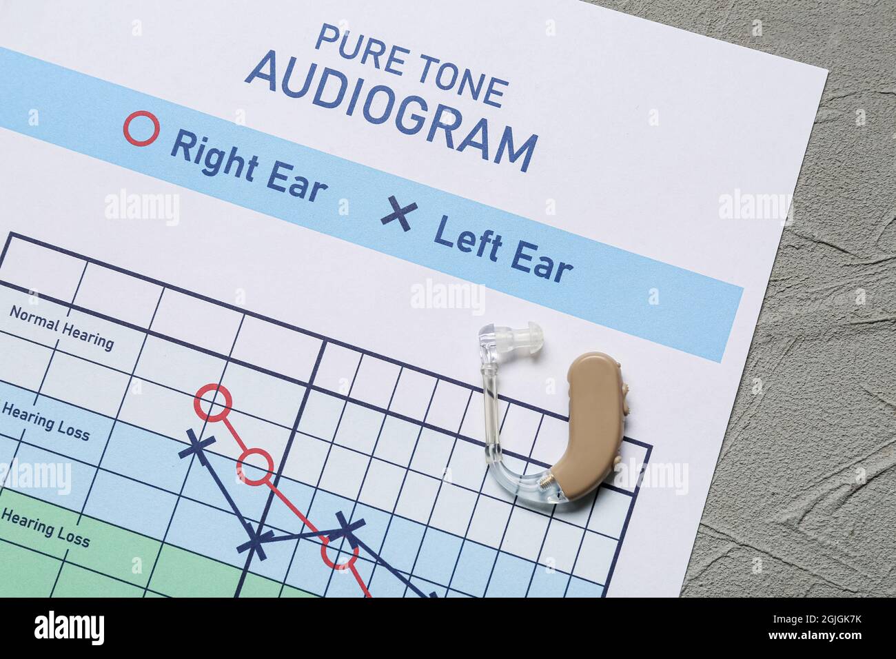 Audiogram with hearing aid on grunge background Stock Photo - Alamy
