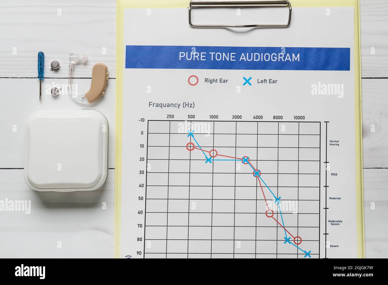 Audiogram with hearing aid and accessories on white wooden background ...