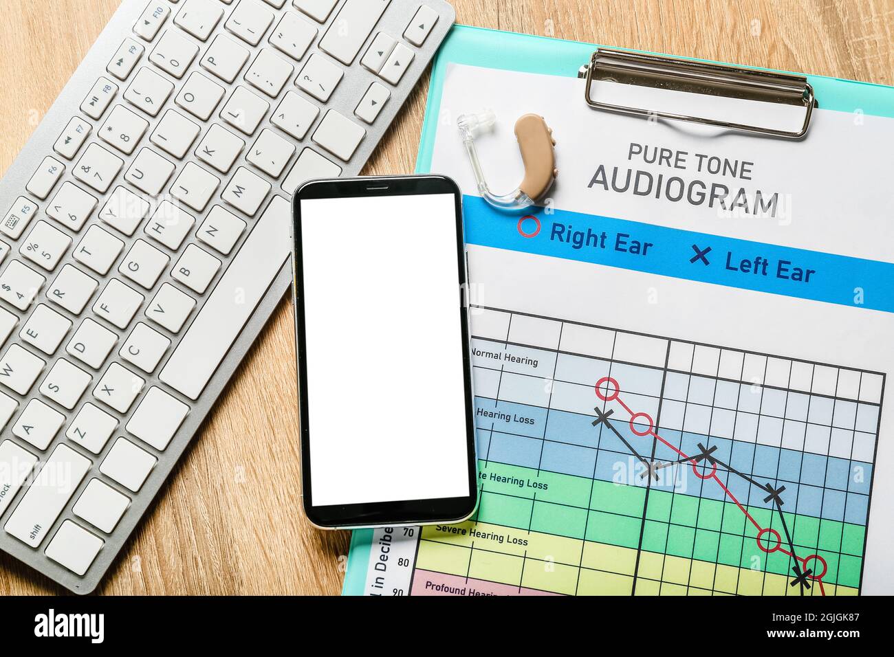 Audiogram with hearing aid and gadgets on wooden background Stock Photo ...