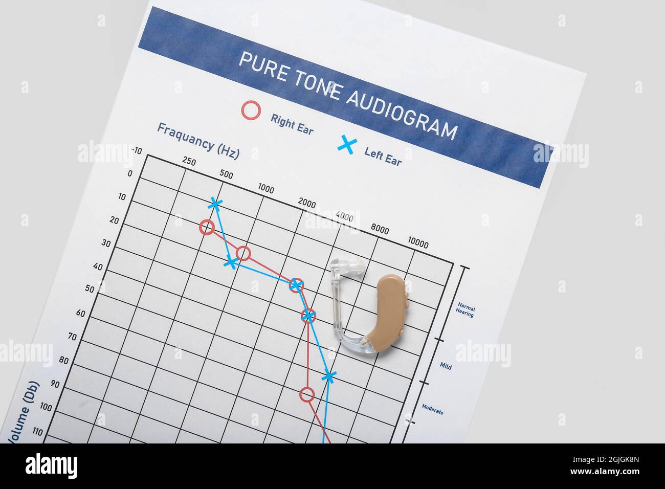 Audiogram hi-res stock photography and images - Alamy