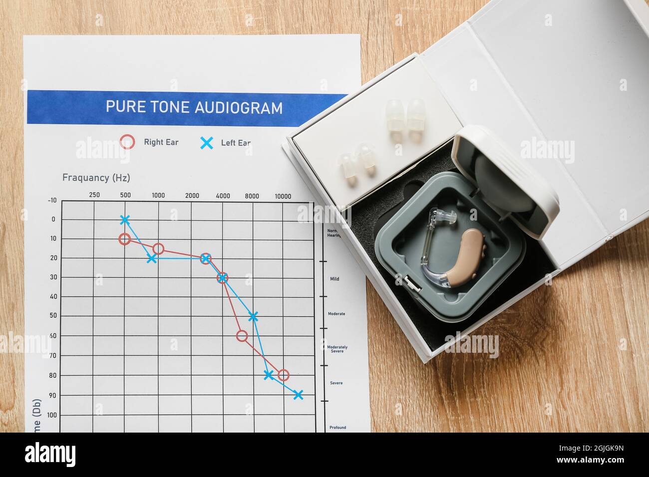 Box with hearing aid and audiogram on wooden background Stock Photo - Alamy