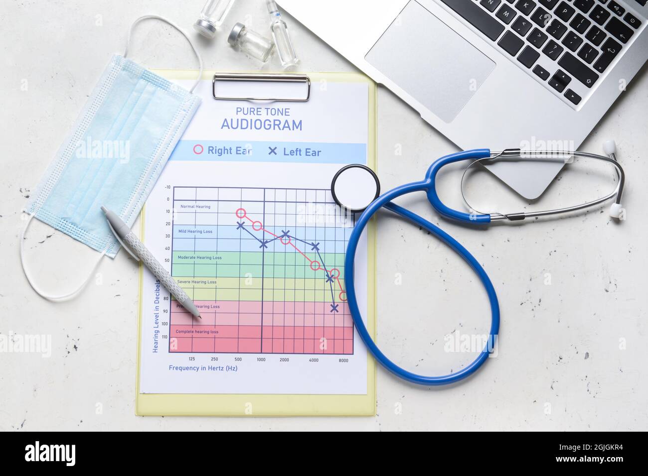 Audiogram, stethoscope, medical mask and laptop on light background ...
