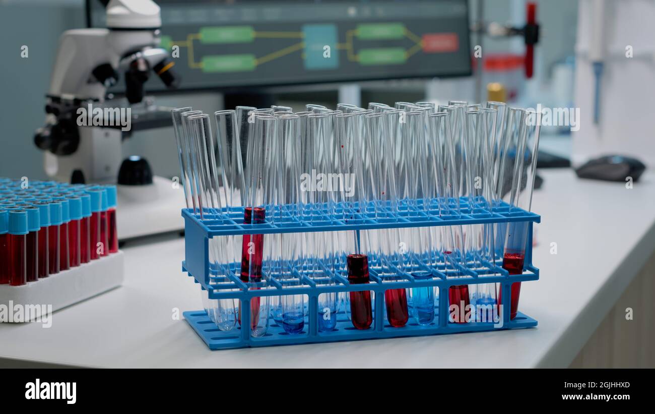 Close up of glassware for fluid solution or dna in laboratory on desk ...