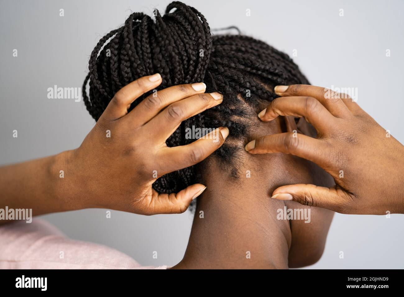 Itching skin, african american hi-res stock photography and images - Alamy