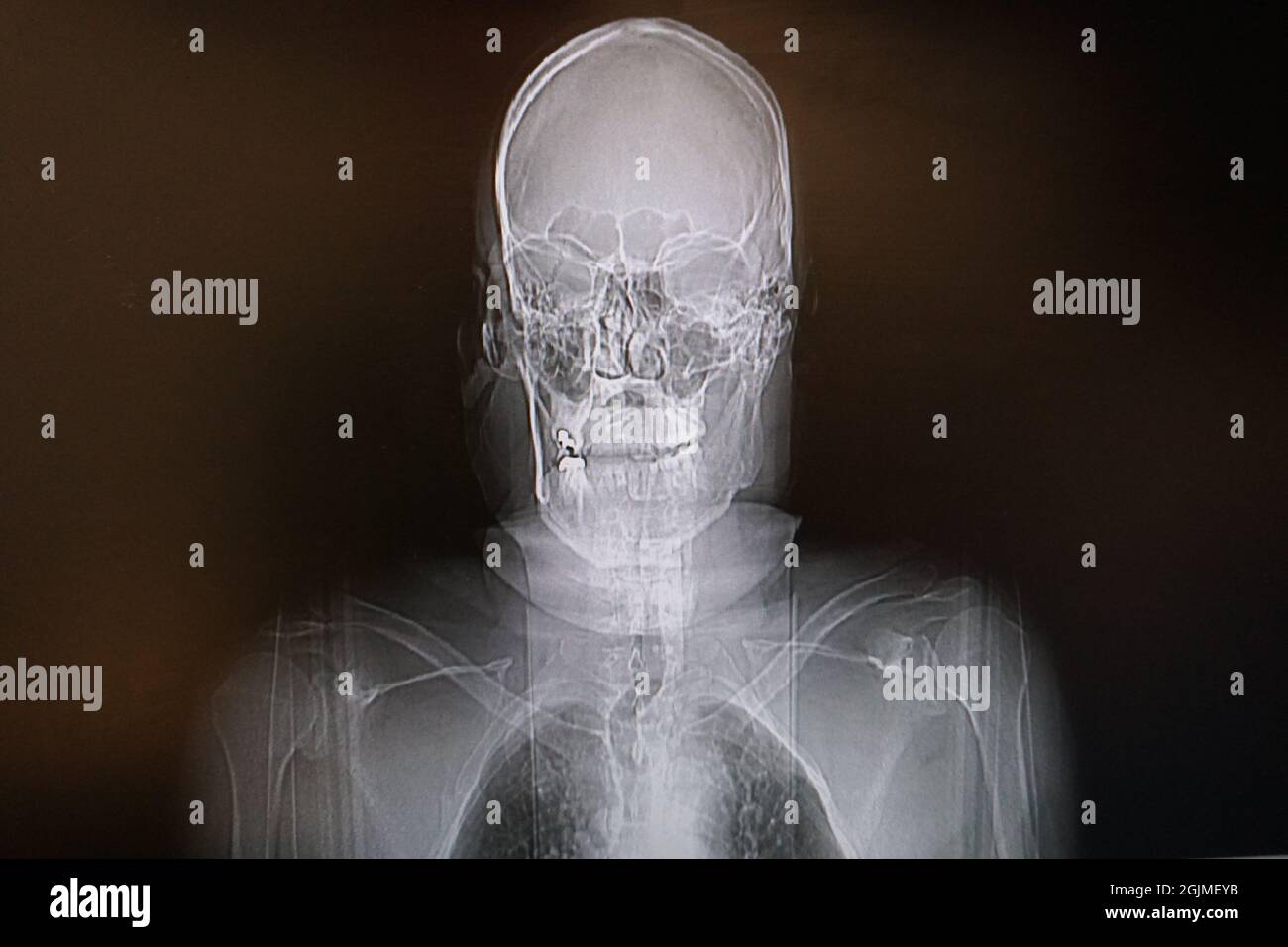 X-ray image of the human body Stock Photo - Alamy