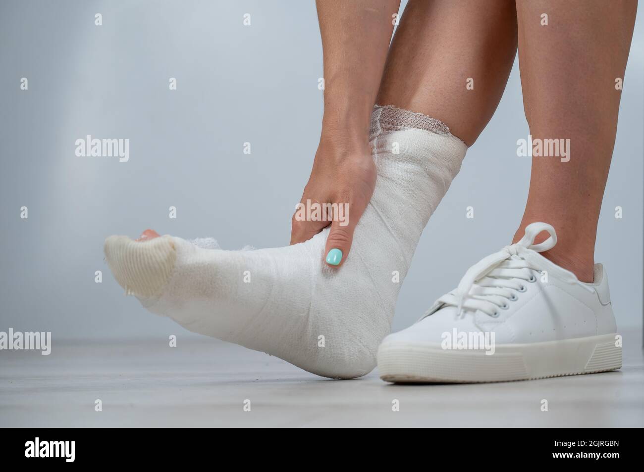 Close-up of female legs with plaster cast. A woman with a broken leg ...