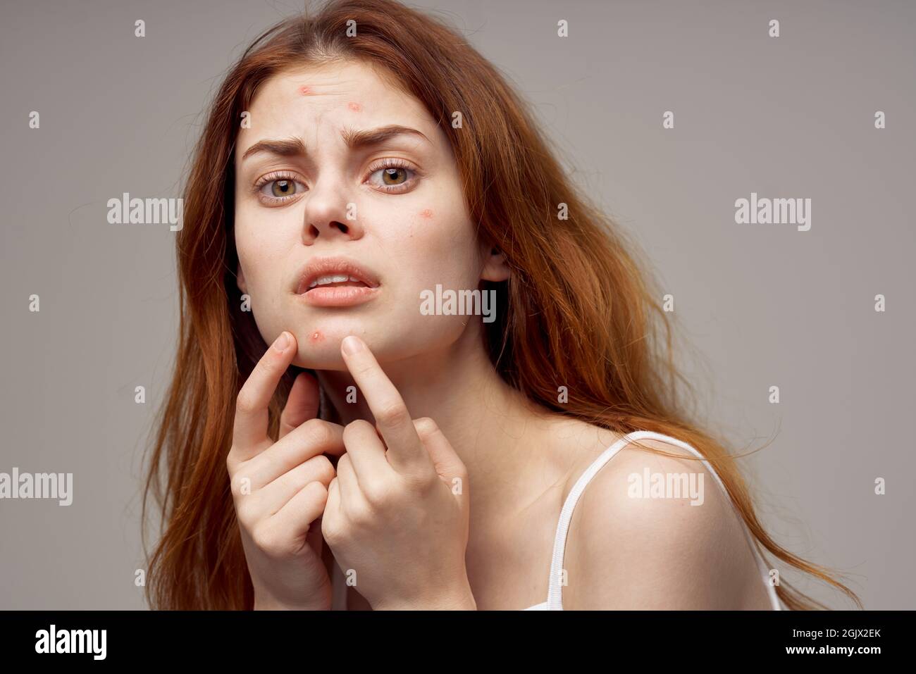pretty woman facial skin problems dermatology isolated background Stock ...