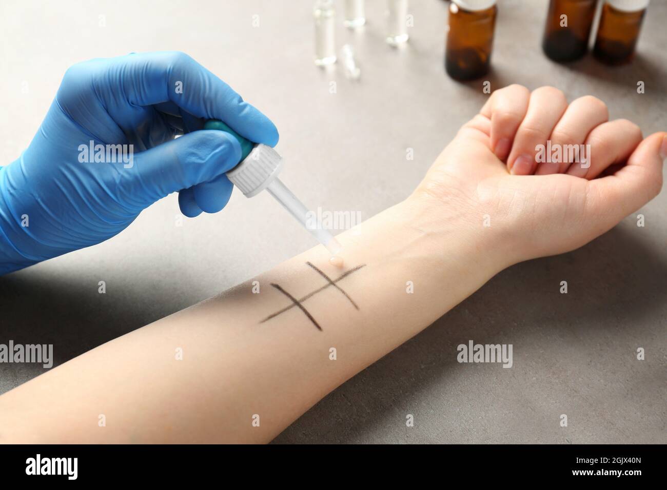 Patient making allergy test in laboratory Stock Photo - Alamy