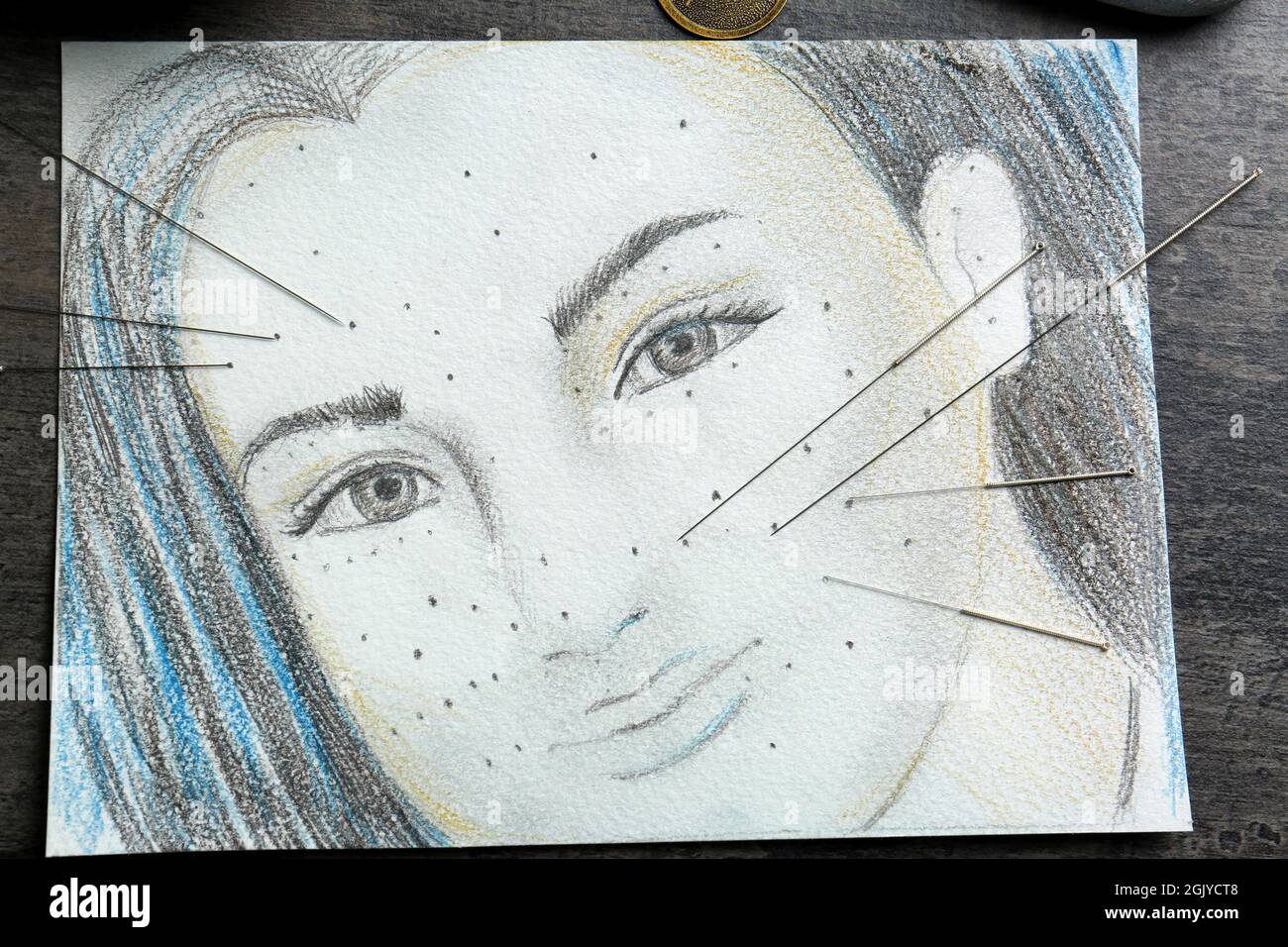 Acupuncture Drawing High Resolution Stock Photography and Images - Alamy