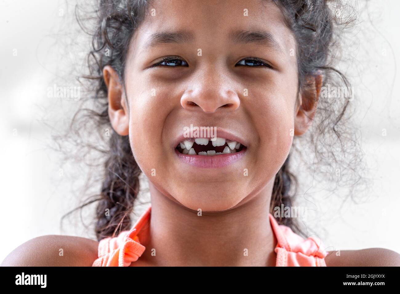 Broken teeth hi-res stock photography and images - Alamy