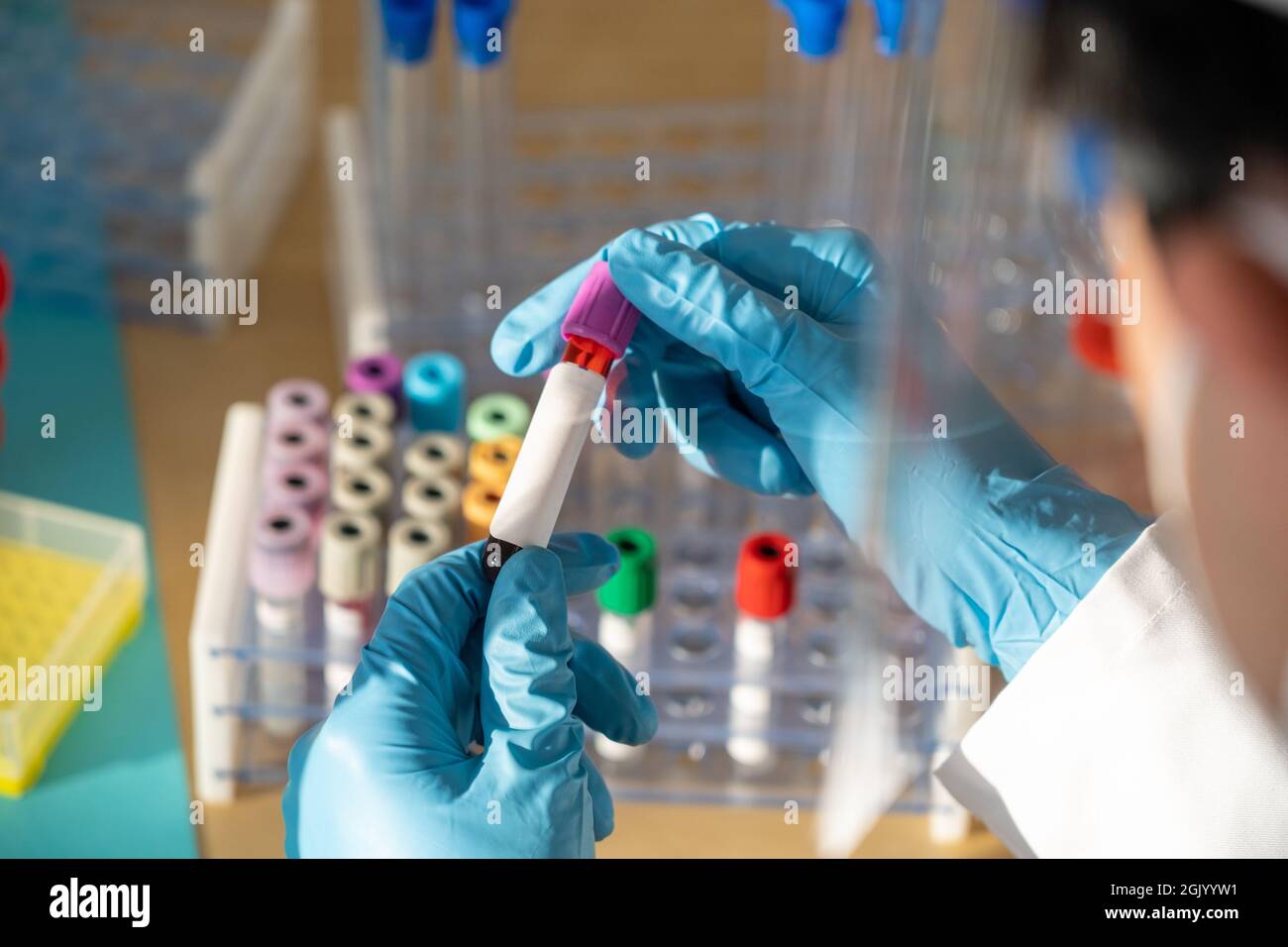 Laboratory technician performing blood tests in the laboratory Stock ...