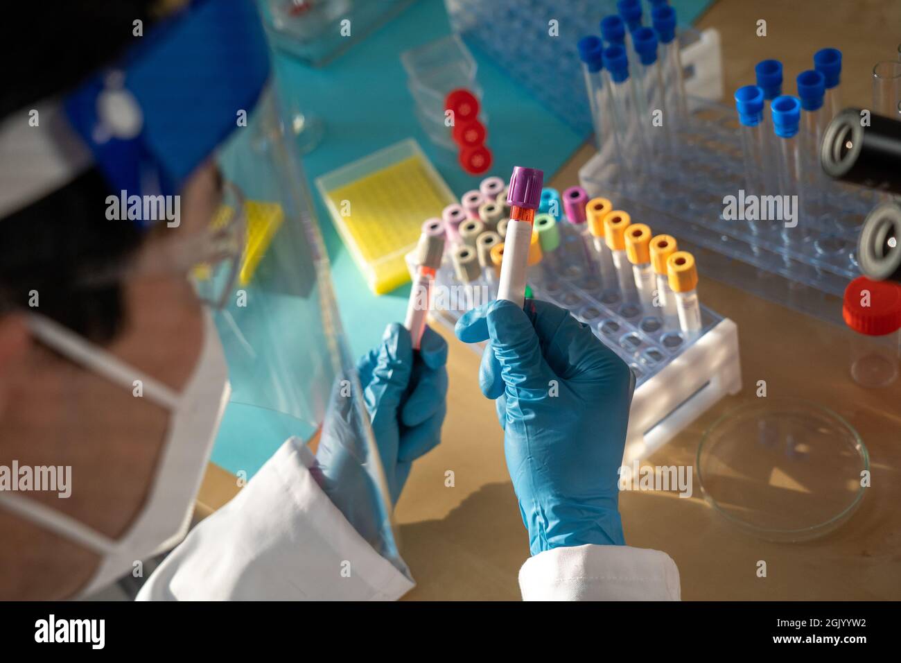 Laboratory technician performing blood tests in the laboratory Stock ...