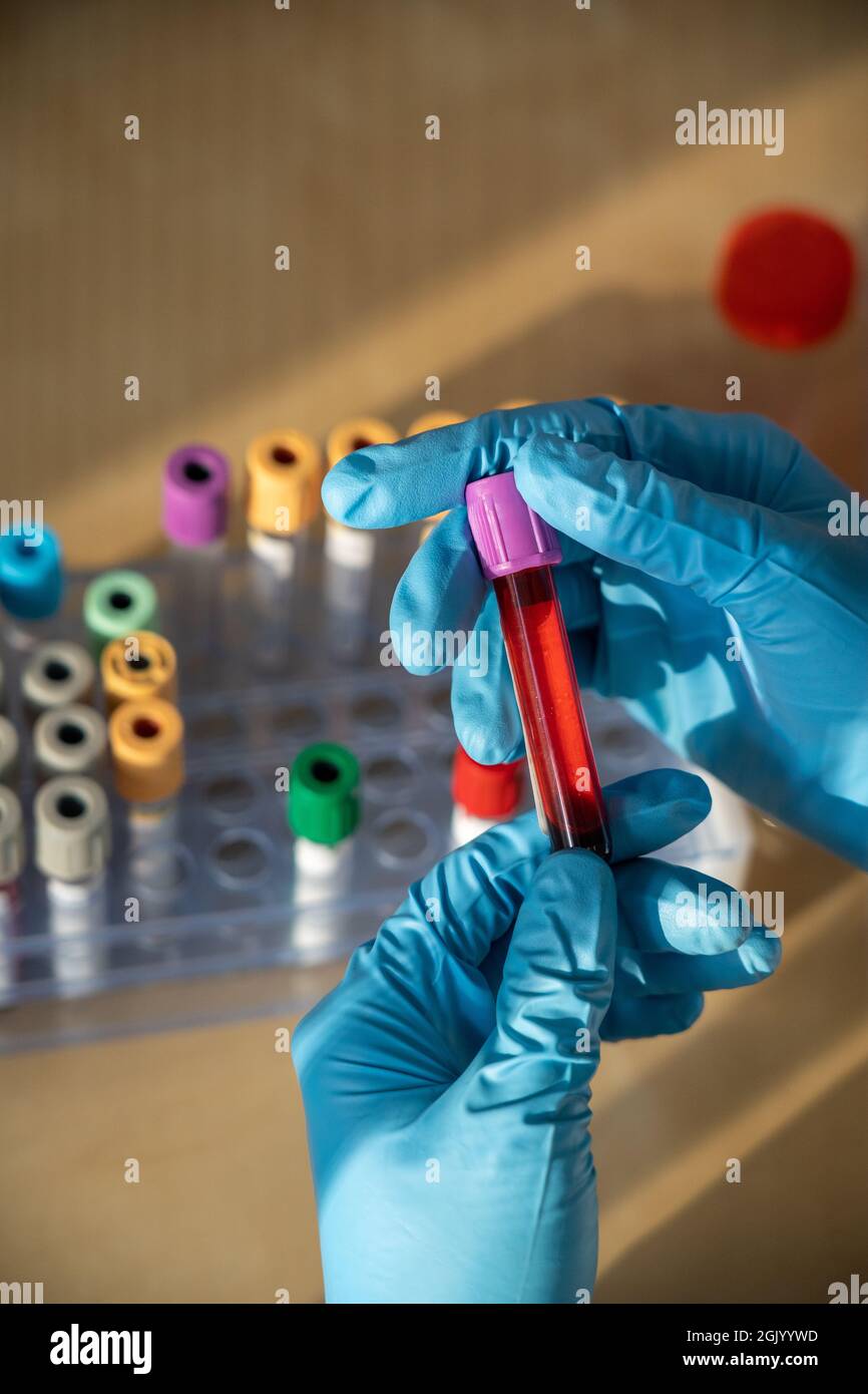 Laboratory technician performing blood tests in the laboratory Stock ...