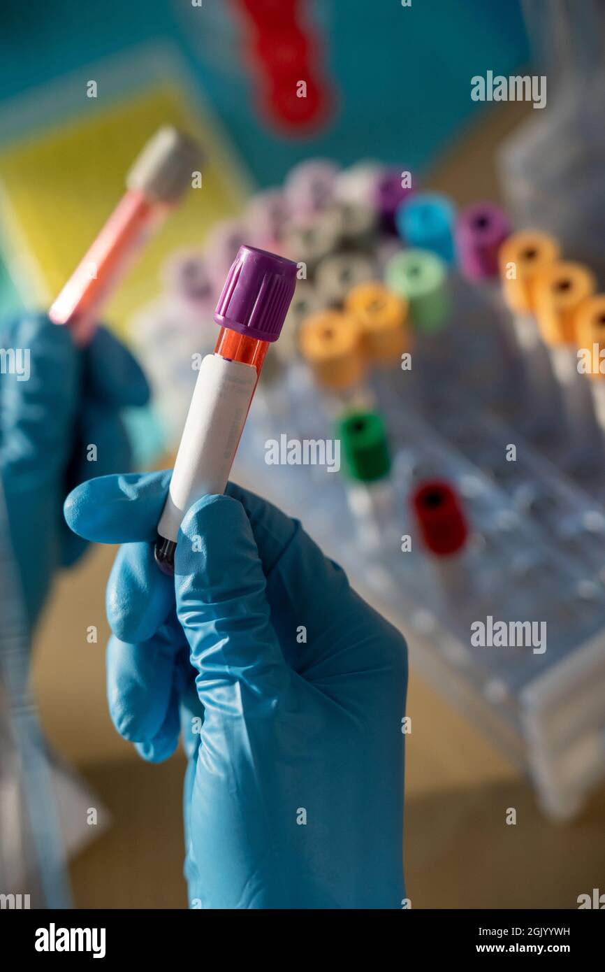 Laboratory technician performing blood tests in the laboratory Stock ...
