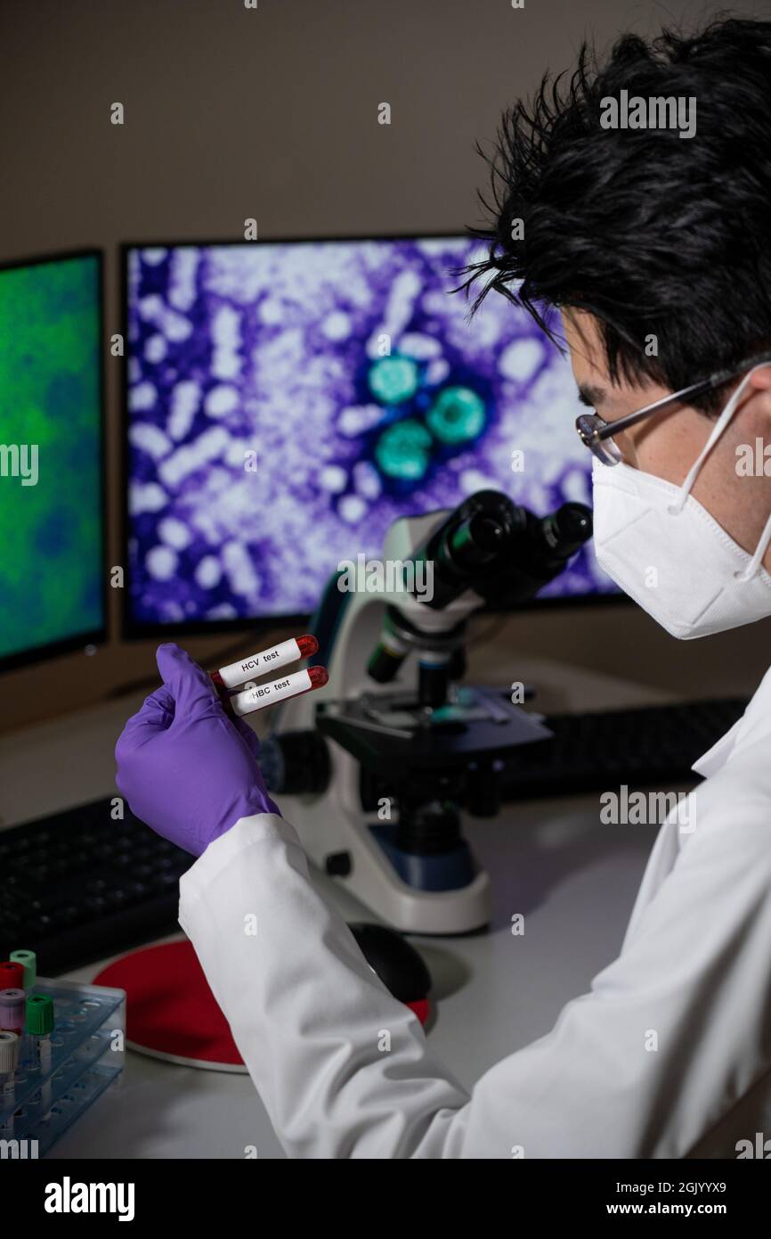 Blood tests for hepatitis B (HBC) and C (HCV Stock Photo - Alamy