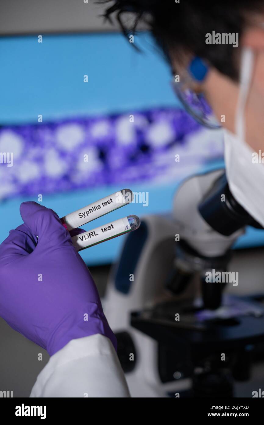 Blood test for syphilis caused by the bacterium treponema pallidum or ...