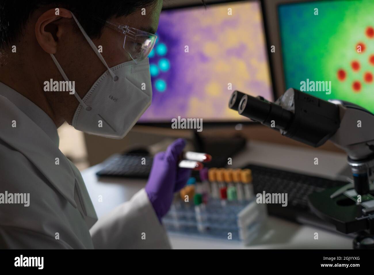 Blood tests to detect hepatitis B (HBC) and C (HCV), viruses visible on ...
