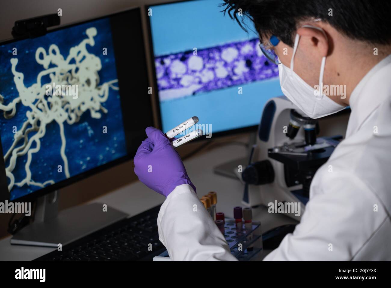 Blood test for syphilis caused by the bacterium treponema pallidum or ...