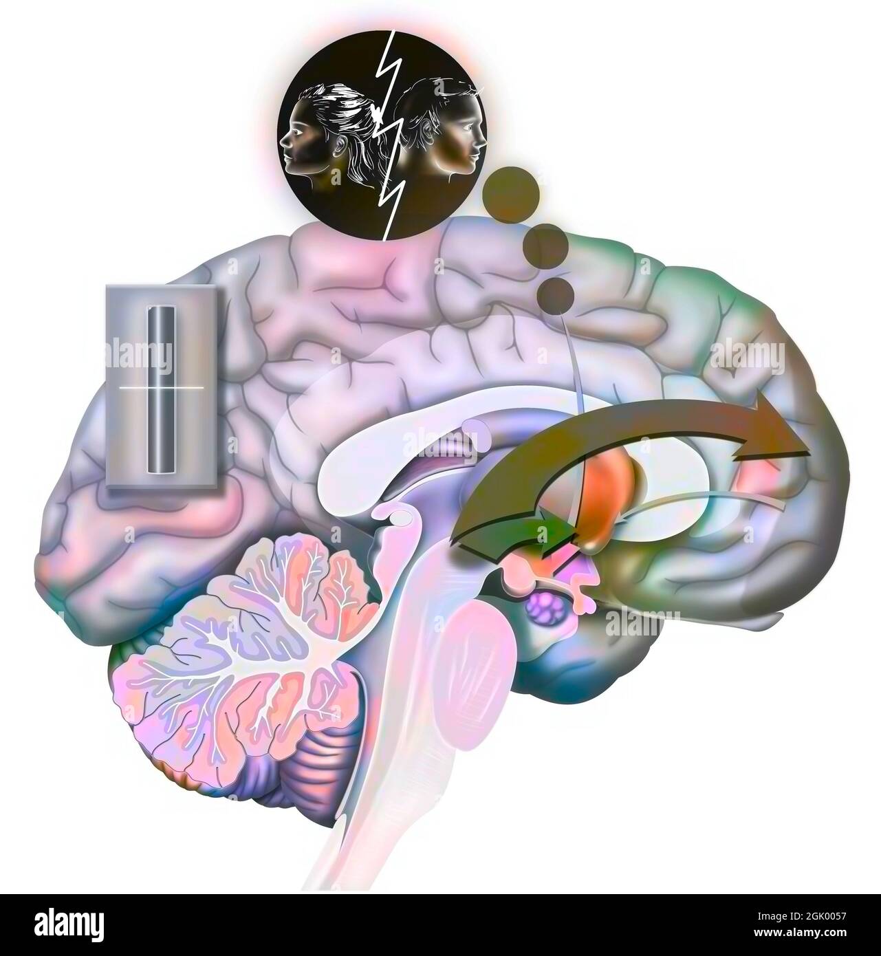 Desire and rupture (state 3): reaction of the brain after a romantic ...