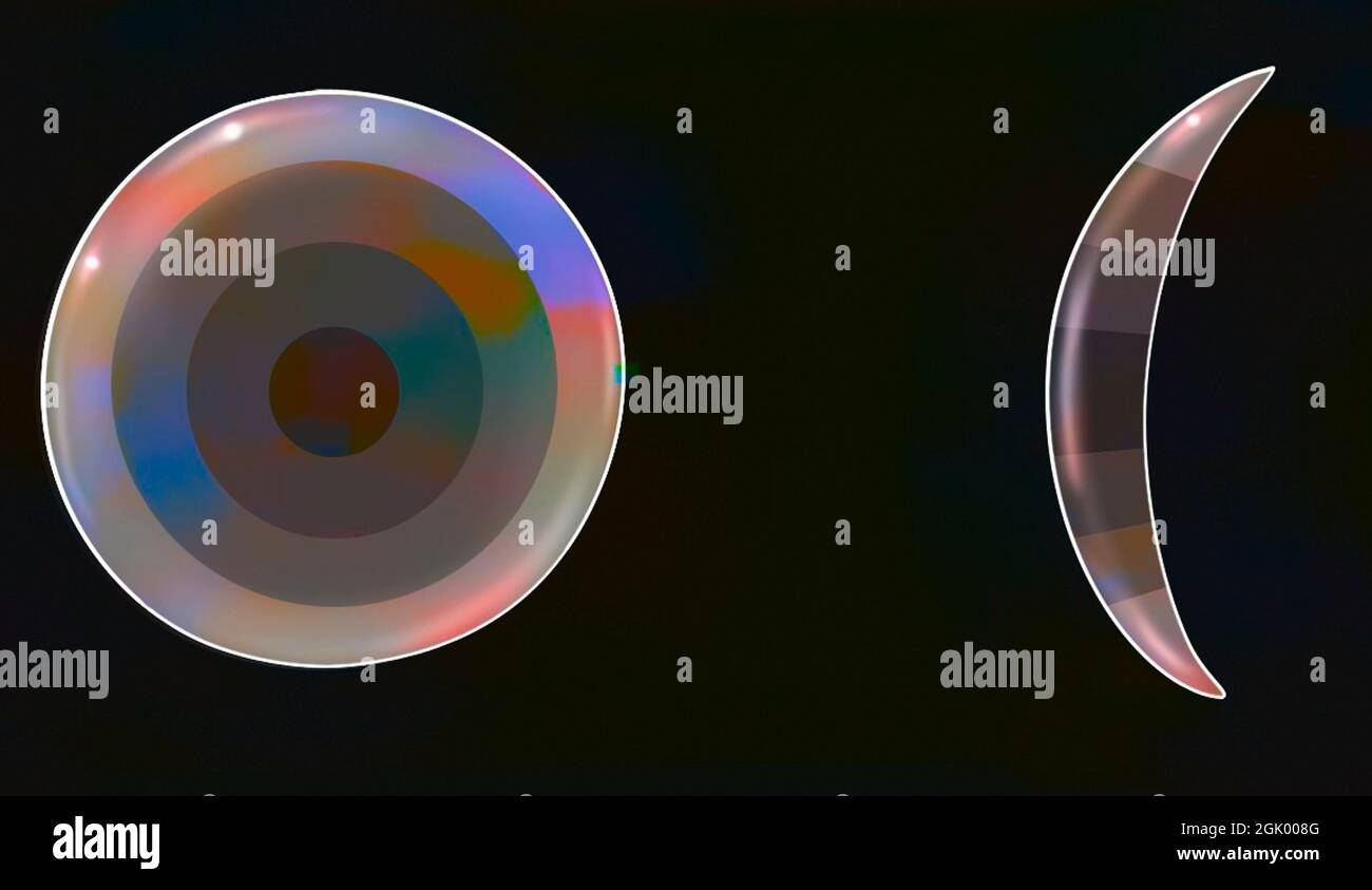 Correction of presbyopia: aspherical alternating vision contact lens ...