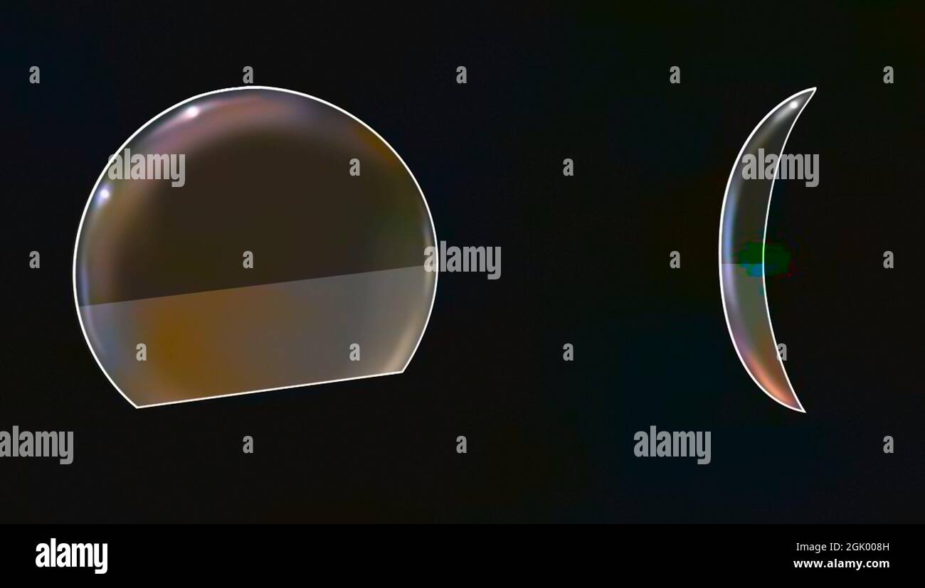 Correction of presbyopia: segmented alternating vision contact lens ...