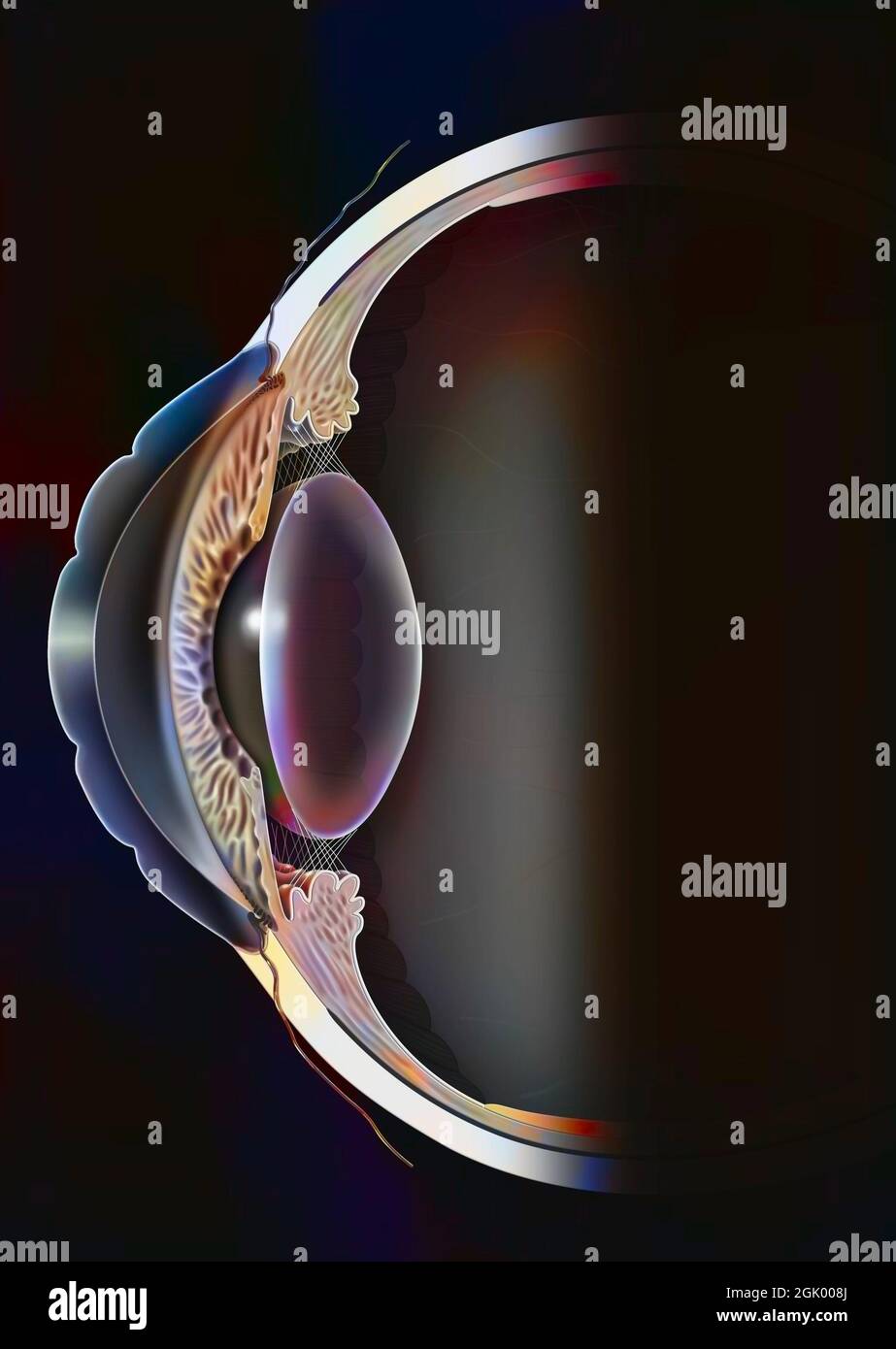 Bifocal lasik hi-res stock photography and images - Alamy