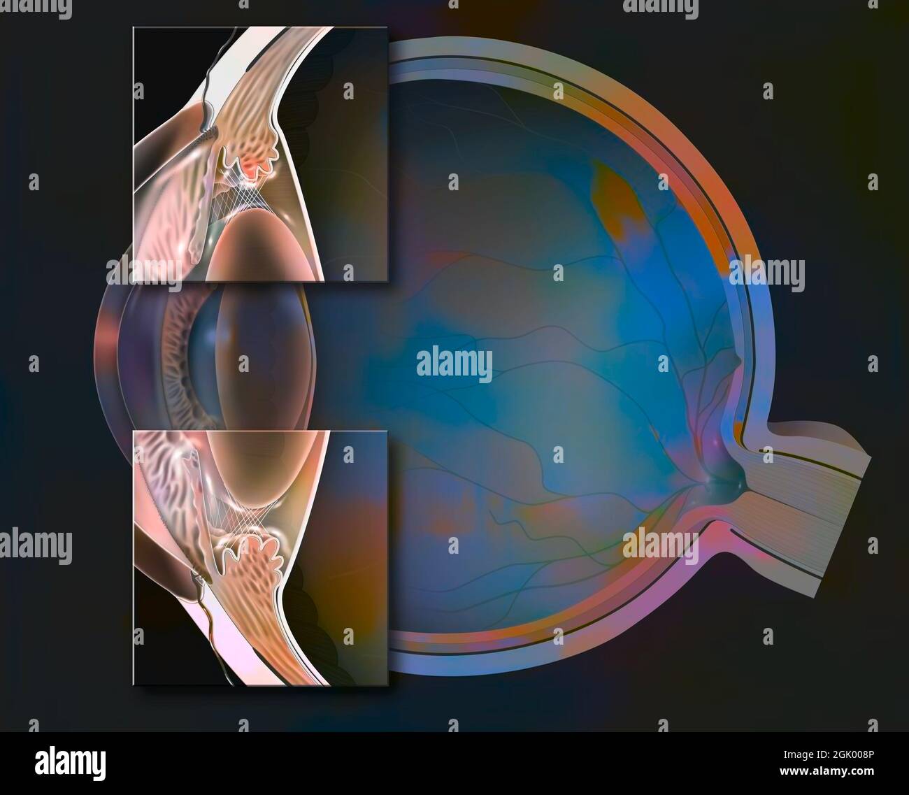 Eye: visual accommodation allows a clear image to be sent to the retina ...