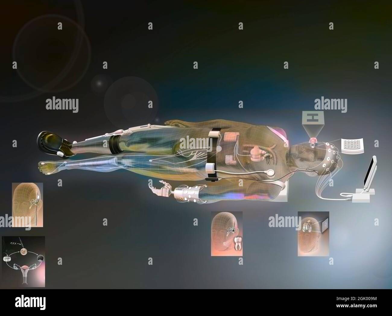 Cochlear implant surgery hi-res stock photography and images - Alamy