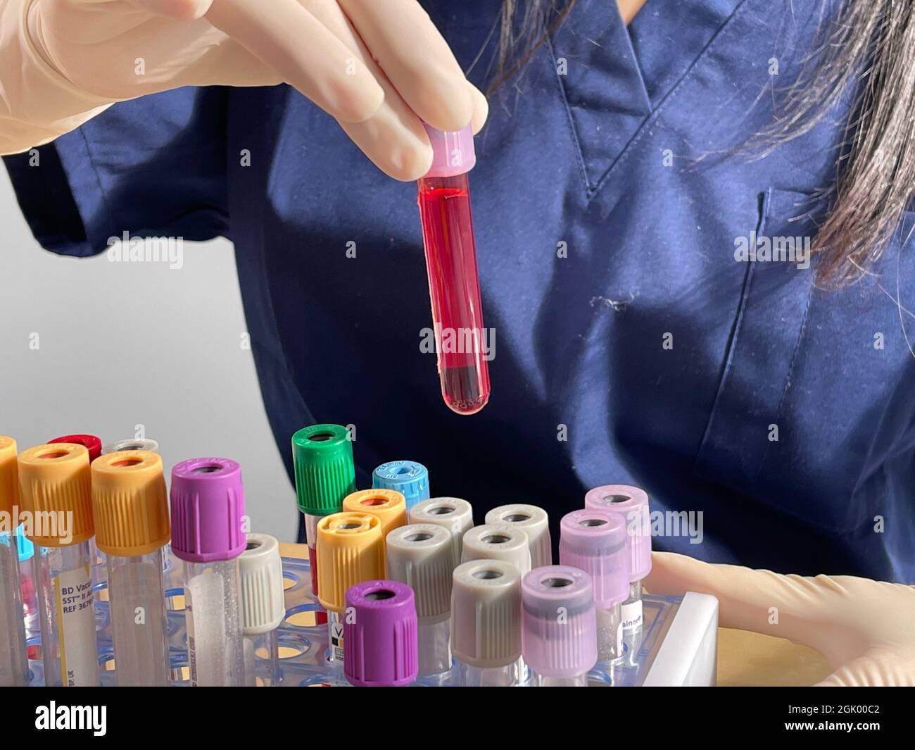 The serological test is done with a blood test to look for the presence ...