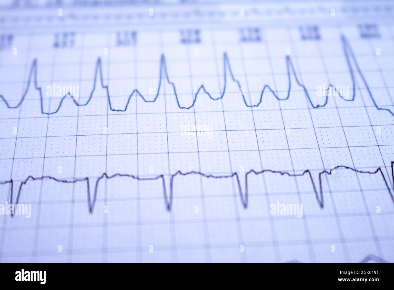 Electrocardiogram ekg graph printout hi-res stock photography and ...