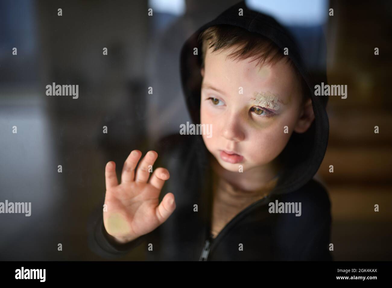 Poor sad small boy with cut eyebrow standing indoors at home, poverty ...