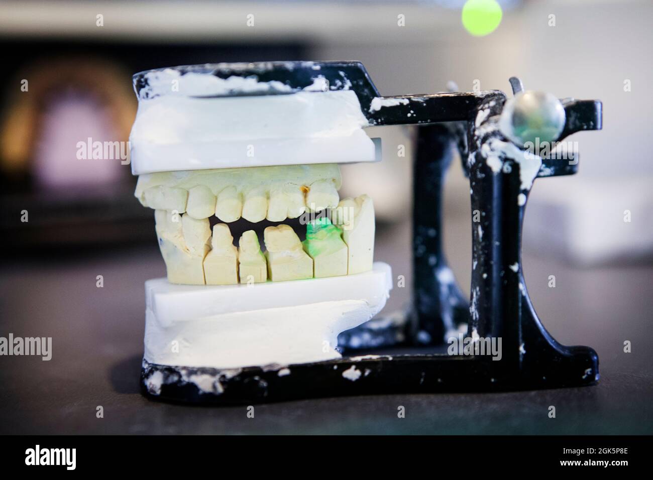 Dental prostheses and Computer Aided Design Manufacturing system from a ...