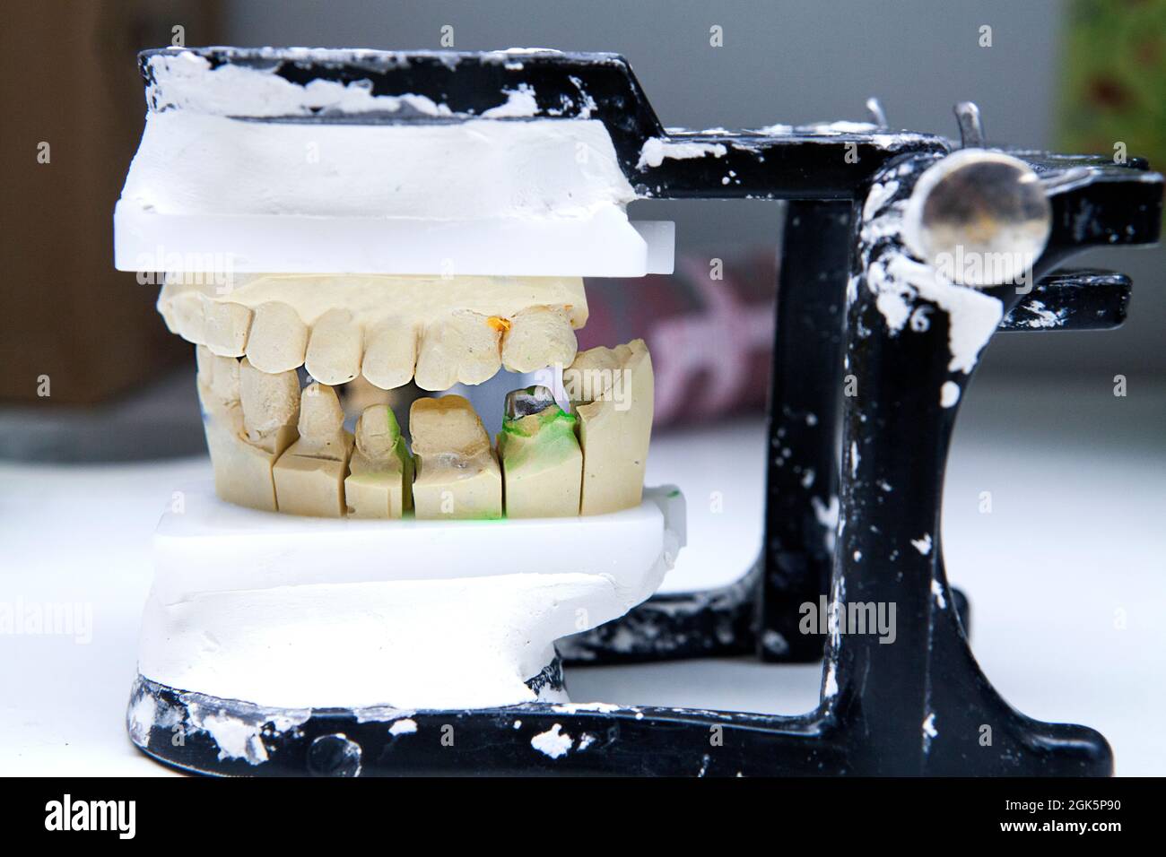 Dental prostheses and Computer Aided Design Manufacturing system from a ...