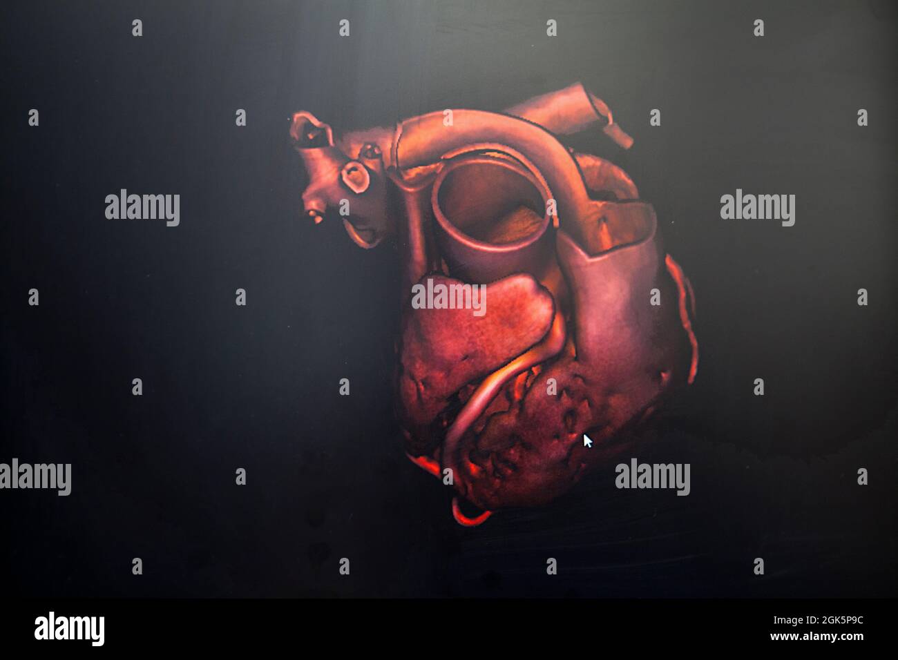 3D reconstruction from patient images, heart image allowing 3D printing ...