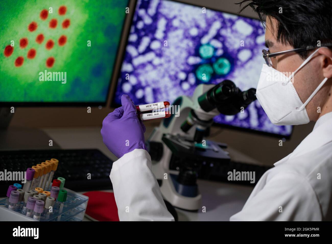 Blood tests for hepatitis B (HBC) and C (HCV Stock Photo - Alamy