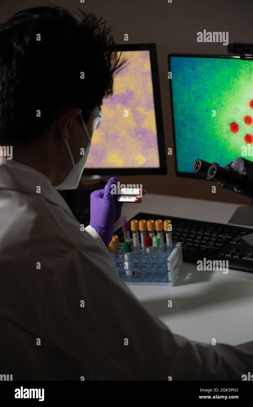 Blood tests to detect hepatitis B (HBC) and C (HCV), viruses visible on ...