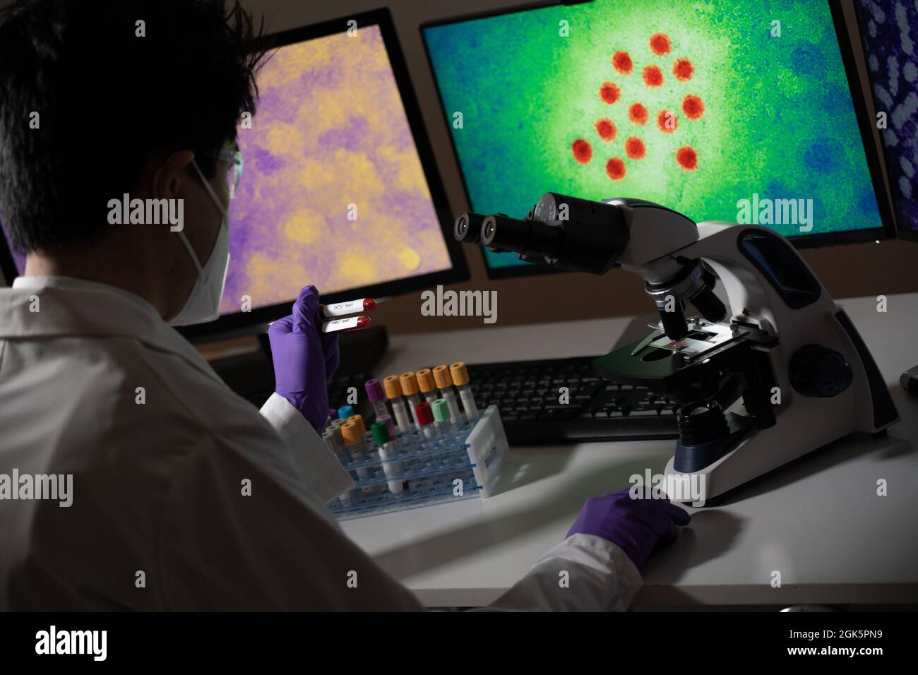 Hepatitis b viruses, tem hi-res stock photography and images - Alamy