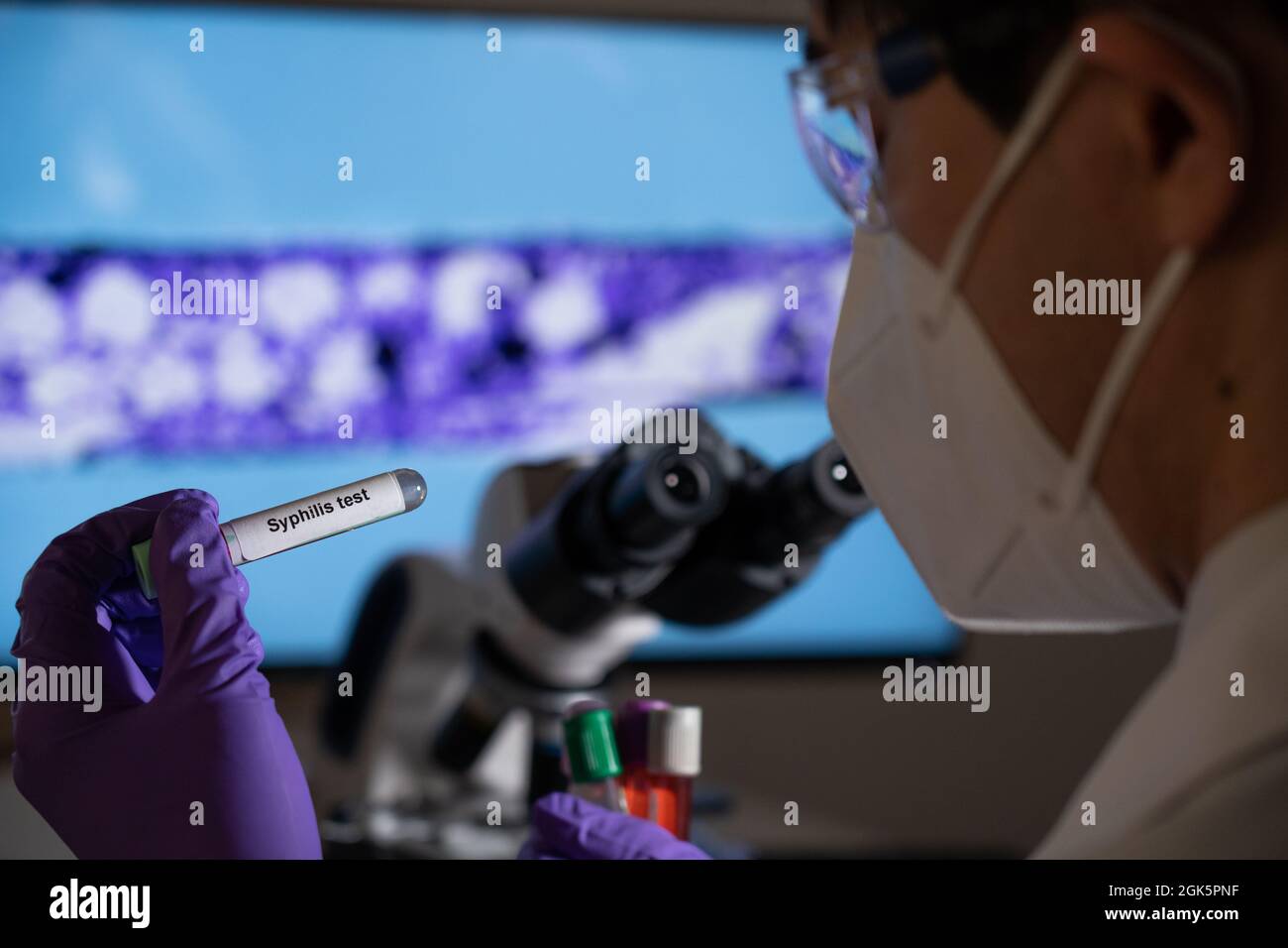 Blood test for syphilis caused by the bacterium treponema pallidum or ...