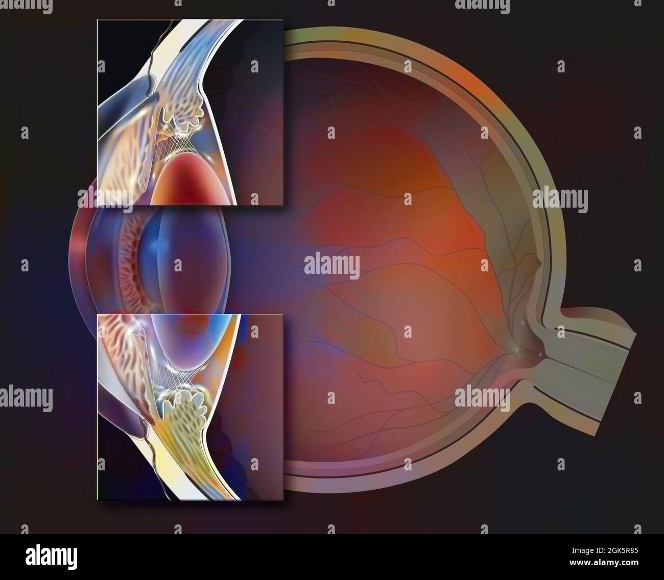 Eye: visual accommodation allows a clear image to be sent to the retina ...
